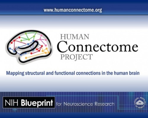 The Developing Human Connectome Project
