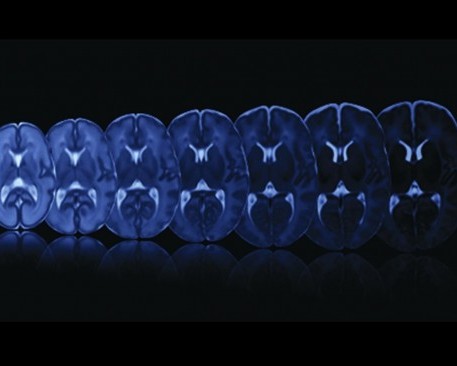 The Developing Human Connectome Project