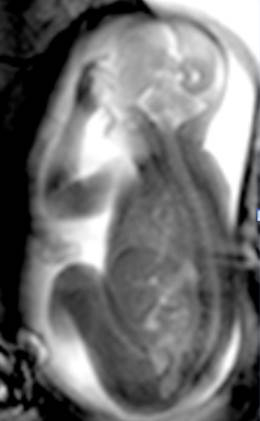 Overview | iFIND: intelligent Fetal Imaging and Diagnosis